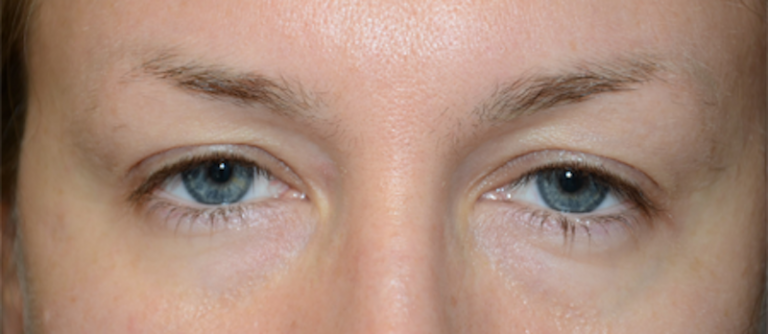 Signs Of Poor Health That Should Not Be Ignored | Page 38 | Things Health