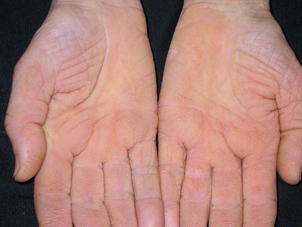 Visual Signs of Poor Health That You Probably Ignore (But Shouldn’t ...