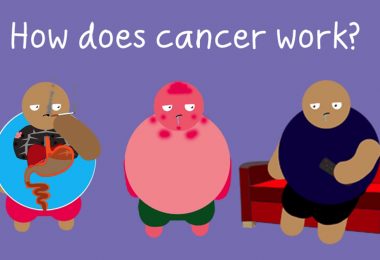 Tag: why does cancer kill you | Things Health
