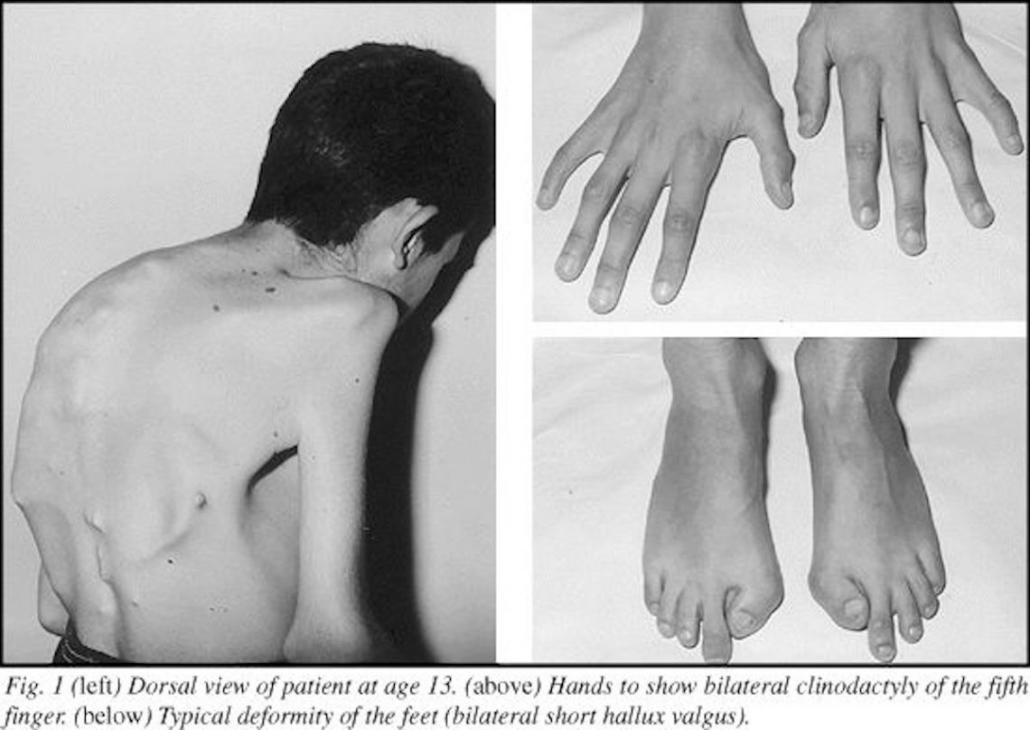 The Rarest Medical Conditions in the World | Page 2 | Things Health