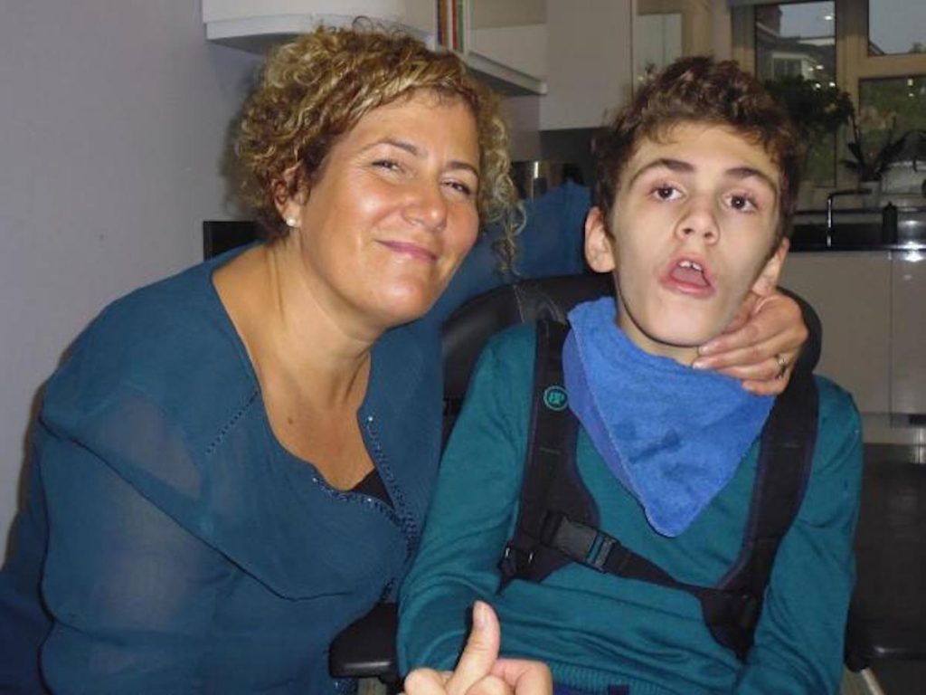 The Rarest Medical Conditions in the World | Page 4 | Things Health