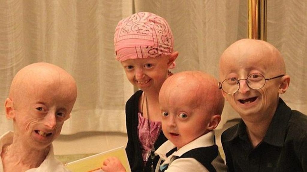 The Rarest Medical Conditions in the World | Page 3 | Things Health