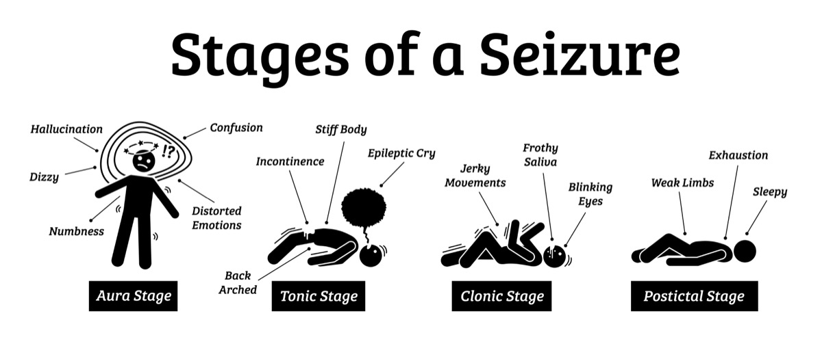 Risk Factors For Epilepsy Page 8 Things Health